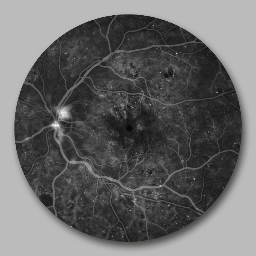 Pathology